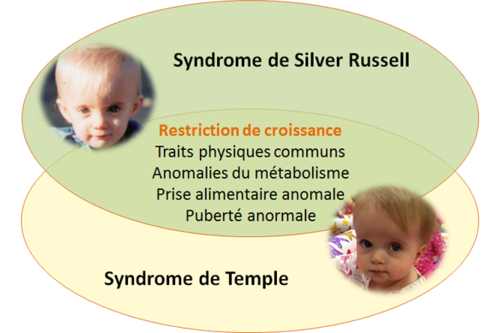 Syndrome de Silver-Russell et syndrome de Temple : nouvelles avancées ...